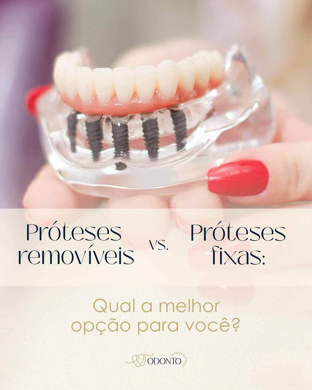 Prótese removíveis & Próteses fixas: Qual a melhor opção para você ...
